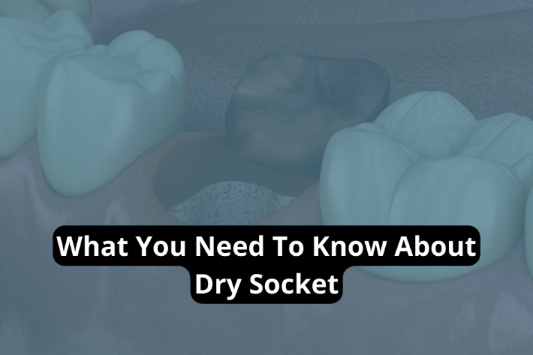 What You Need To Know About Dry Socket - Austin, TX - Four Points Dental
