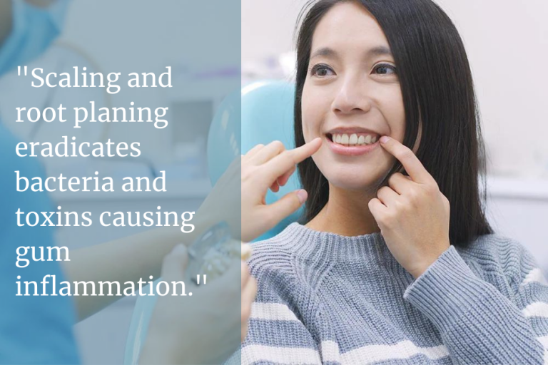 Scaling and Root Planing: The Cornerstone of Periodontal Health ...